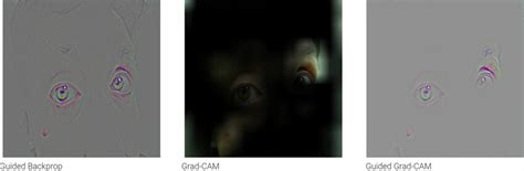 Gradient Weighted Class Activation Mapping Grad Cam Of An Uploaded