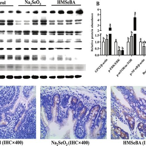 Effect Of Maternal Se Supplementation During Gestation On Serum Download Scientific Diagram