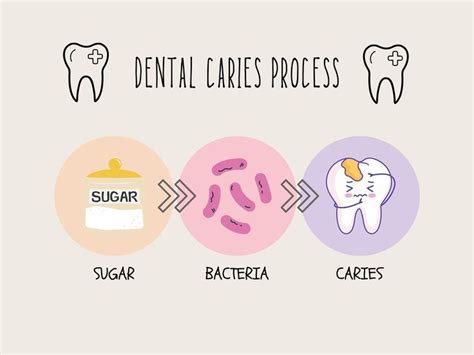 Dental Caries Process Dental Quotes Dental Caries Teeth Health