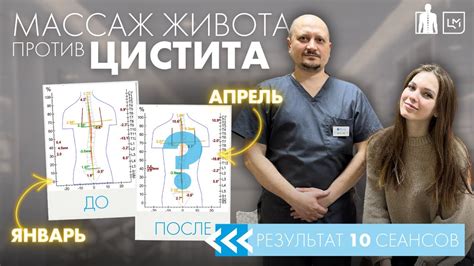 Массаж живота при цистите и боли в спине Результаты висцеральной терапии Центр Механотерапии