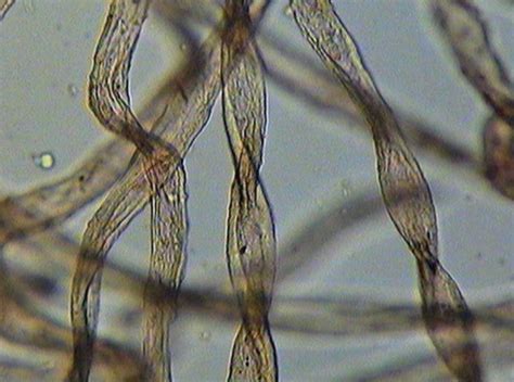 Microscopic Pictures Of Fibers Flashcards Quizlet