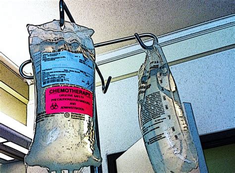 Potential Seen To Tailor Acute Myeloid Leukemia Treatment Uw Medicine