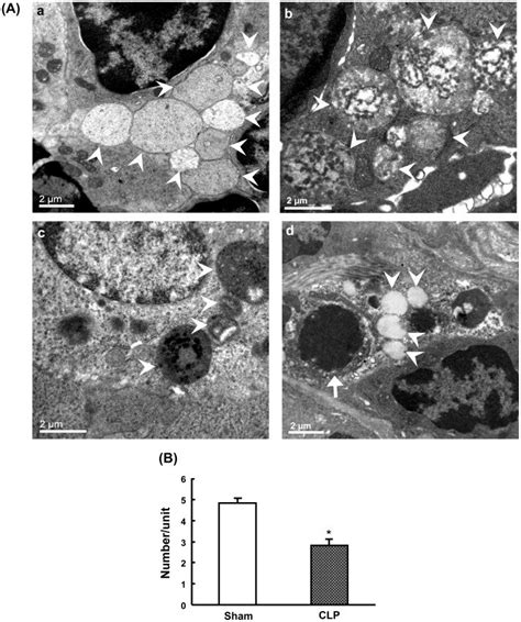 Autophagy Was Mophologically Characterized By Transmission Electron