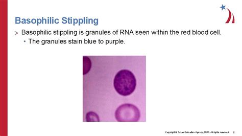Red Blood Cell Morphology Copyright Texas Education Agency