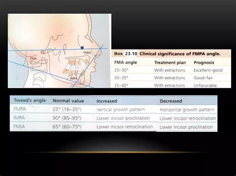 Cephalometrics 2 Ppt