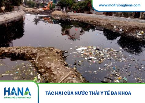 Những đặc điểm nước thải y tế đa khoa là gì