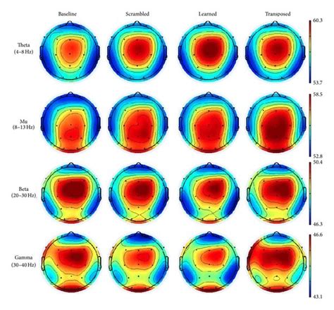 Scalp Distribution Of Different Frequency Band Activities Units For Download Scientific