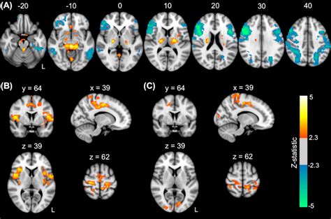 bold fmri correlates of eeg alpha oscillations a regions showing