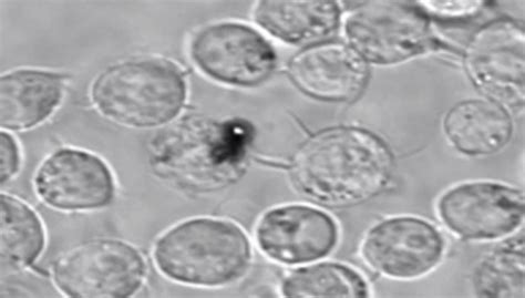 Exploding Cancer Cells