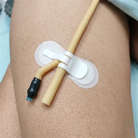 Disposable Dialysis Catheter Fixation Device For Infusion Tube