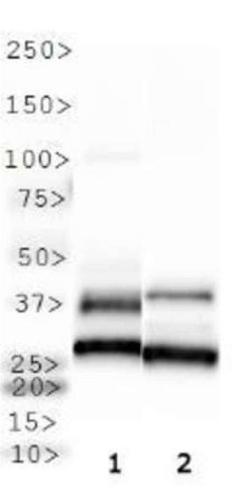 Melatonin Receptor 1b Antibody Bsa Free Novus Biologicalsantibodies