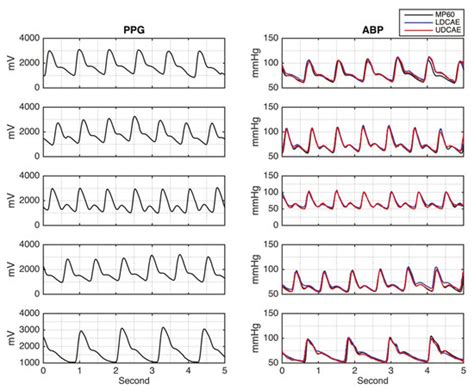 Sensors Special Issue Advanced Signal Processing In Wearable Sensors For Health Monitoring
