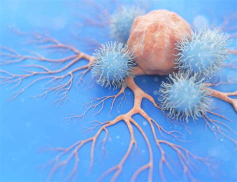 Immunitybio Phase 1 Data Finds Combo May Induce Tumor Regression