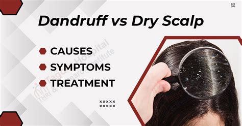Severe Dandruff Scalp