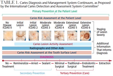 Evolution Of Caries Diagnosis