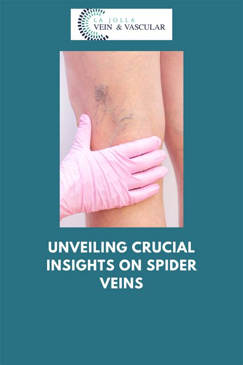 Spider Veins Treatment Vein And Vascular Care Clinic