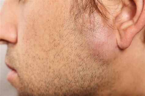 Ultrasound Imaging For Precise Evaluation And Planning Arlington