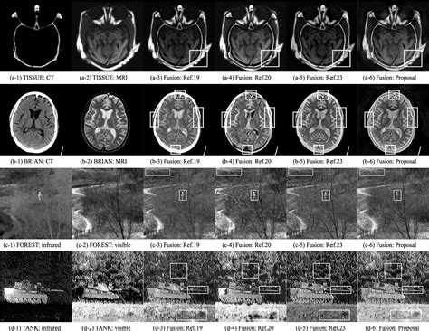 Figure 7 From Image Fusion Method Based On Structure Based Saliency Map And Fdst Pcnn Framework
