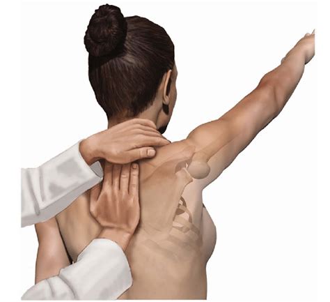 The Scapular Reposition Retraction Test Srt A Manually Assisted Download Scientific Diagram