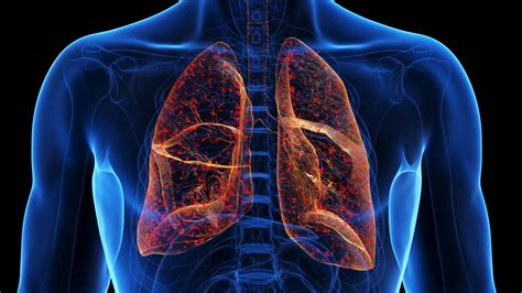 Procalcitonin May Help Reduce Unnecessary Antibiotic Use In Patients With Non Pneumonia Lower