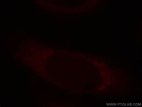 ASAP3 Fusion Protein Ag5826 | Proteintech