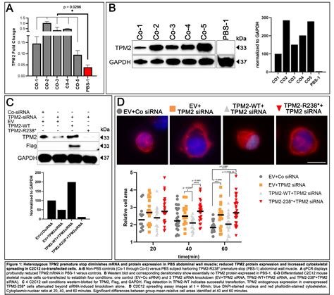 Spu Heterozygous Premature Stop Dna Mutations In Tropomyosin 2 Tpm2