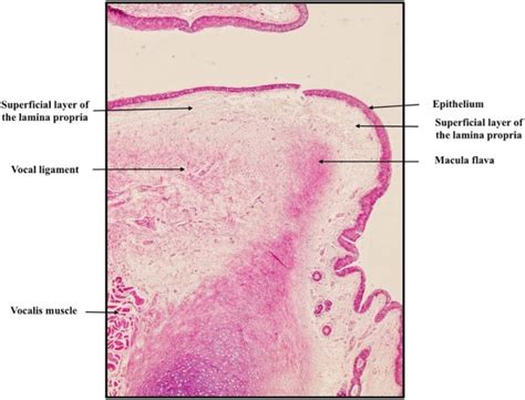 Sex Hormone Receptor Expression In The Human Vocal Fold Subunits Journal Of Voice