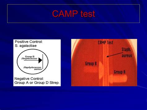 Ppt Diagnosis Of Streptococci Powerpoint Presentation Free Download