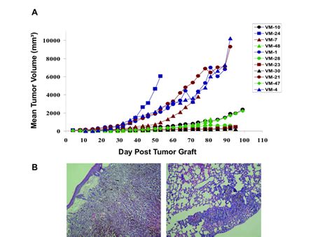 Subcutaneous Growth Of The Indicated 11 Human Melanoma Cell Models In