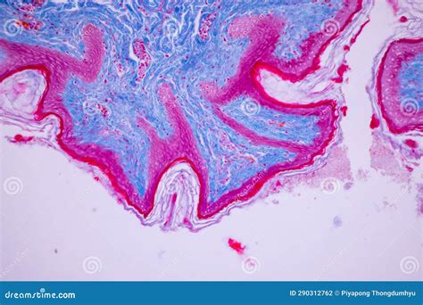 Characteristics Tissue Of Human Scalp Skin Human From General Body