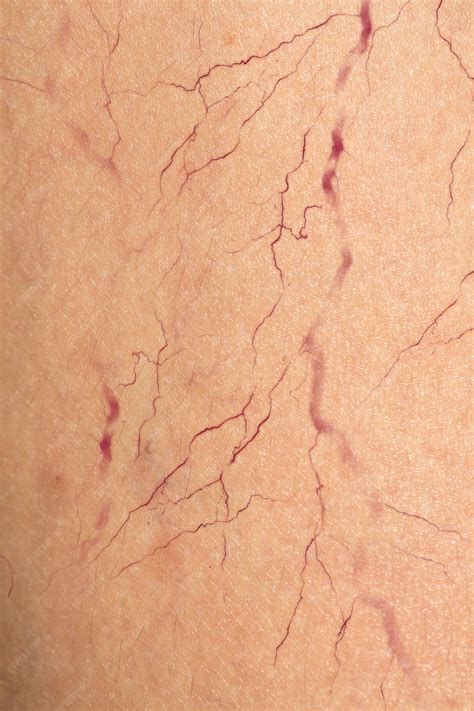 Skin Veins Texture