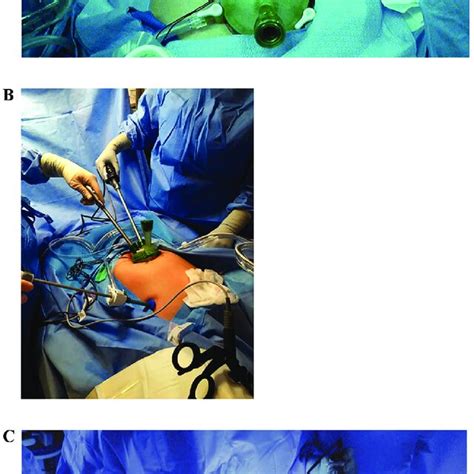 Self Constructed Multichannel Single Site Port Device For Vaginal Download Scientific Diagram
