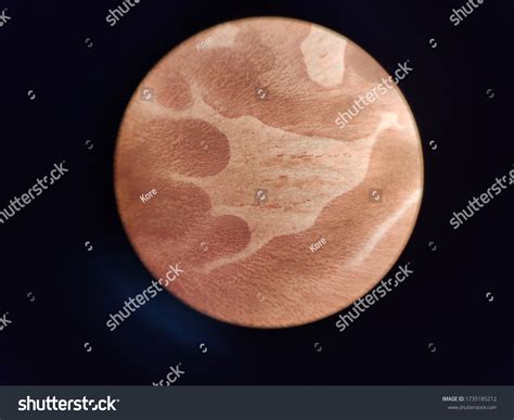Fusarium Oxysporum Fungus Under Microscope Foto Stock 1735185212