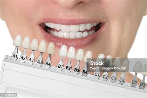 그늘 가이드 표백제 컬러 치아 치아 미백 흰색 배경에 격리 표백 품질 관리 및 색상 검사 여성 크라운 베니어 미소 구강 학으로 완벽한 흰색 미소 자기 그릇에 대한 스톡 사진