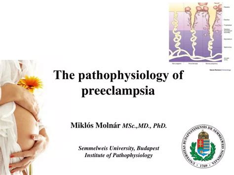 Ppt Τhe Pathophysiology Of Preeclampsia Powerpoint Presentation Free