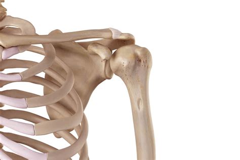 Acromioclavicular Joint Separation