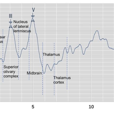 Abnormal Abr Waveform And Data Quantization Method Download Scientific Diagram