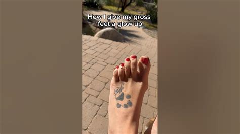 Gross And Ugly Feet Glow Up Foot Care Treatment For Everyone Instant