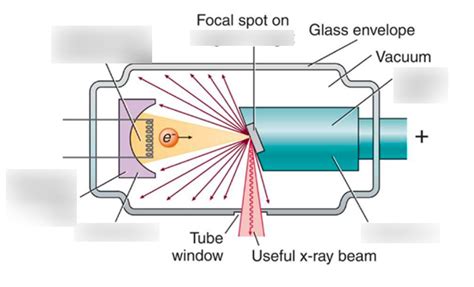 Radiology Quiz 2 Part 2 Diagram Quizlet