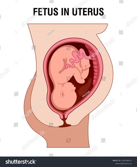 Image Of Uterus During Pregnancy A Pregnant Woman With Acute Abdomen