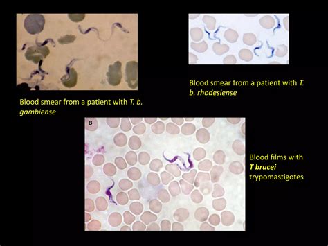 Trypanosomiasis Pdf