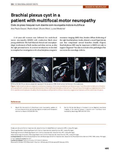 Pdf Brachial Plexus Cyst In A Patient With Multifocal Motor Neuropathy Pedro Alves