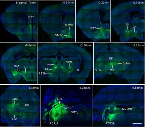 Whole Brain Mapping Of Direct Inputs To And Axonal Projections From