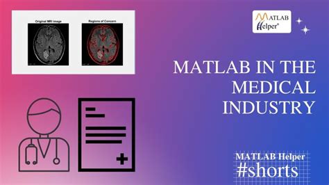 Matlab Helper On Linkedin Matlabhelper Shorts Youtube