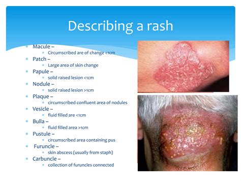 Paediatric Rashes Pptx