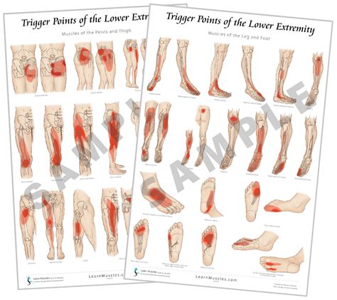 Leg Trigger Points Chart Portal Posgradount Edu Pe