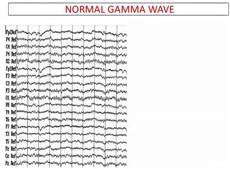 A Deep Dive Into The Gamma Rhythm