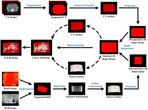 the workflow of the proposed markerless registration method download