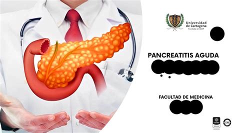 Pancreatitis Aguda Alejandro JosÉ Udocz