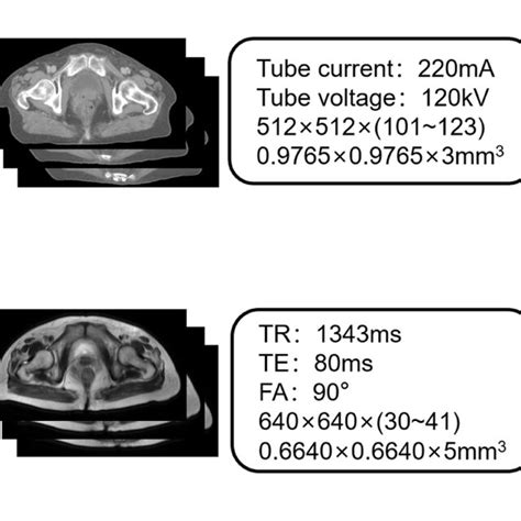 Flowchart Of Ct And Mri Image Data Acquisition And Preprocessing Download Scientific Diagram